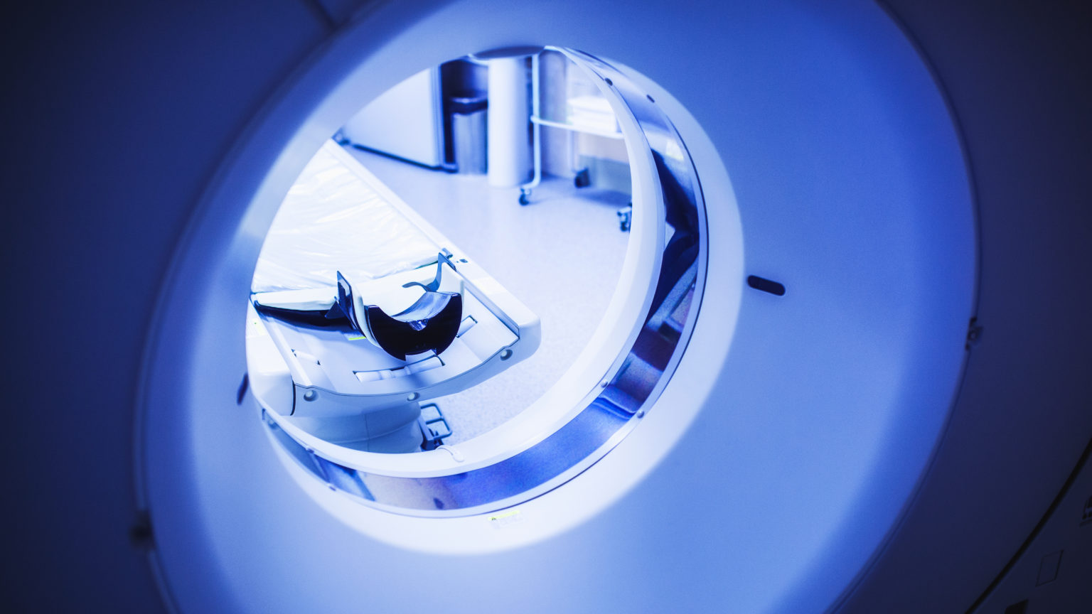 Why are O2 monitors required for MRI units?